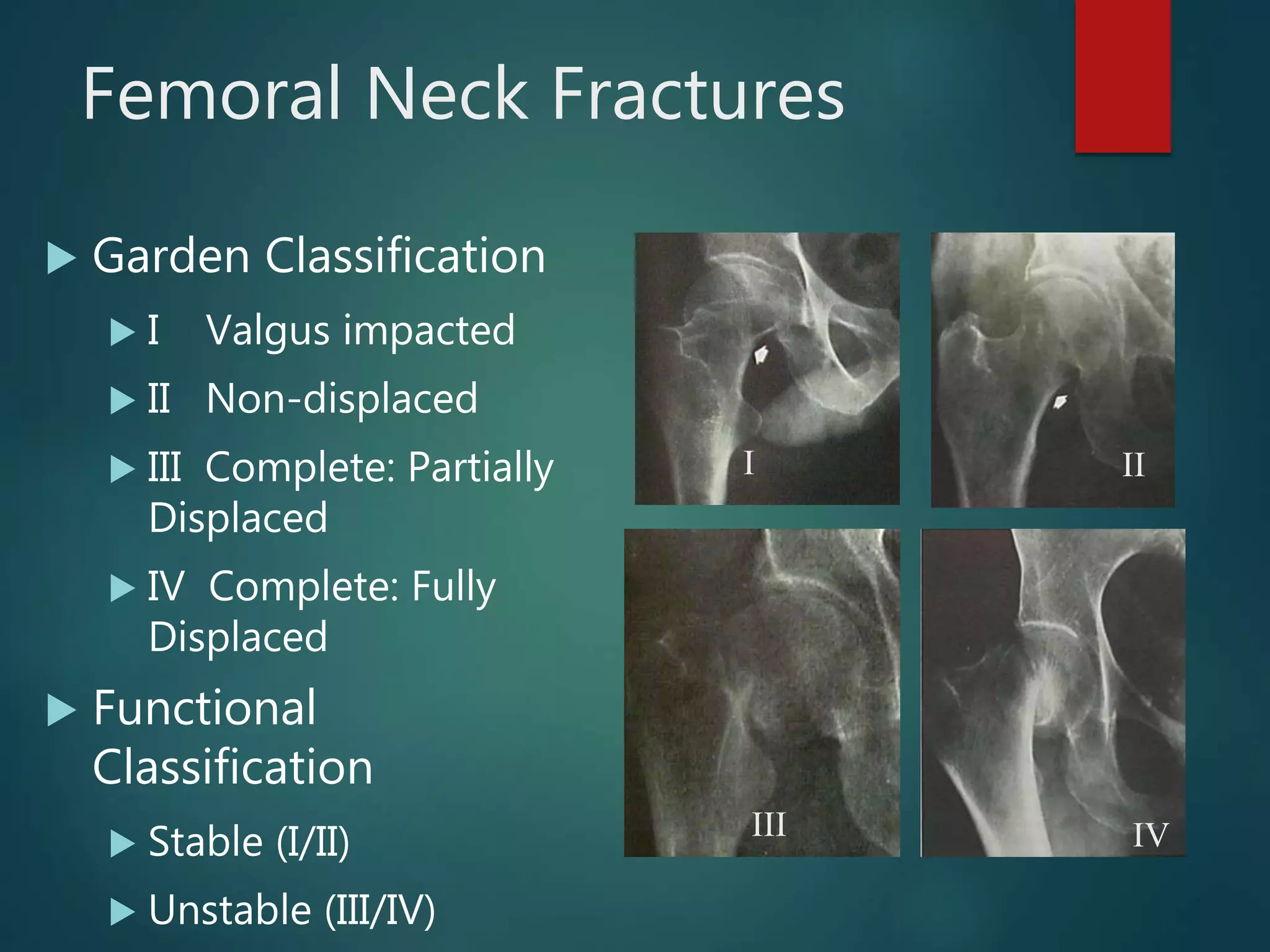 Lower Limb Fractures.pptx