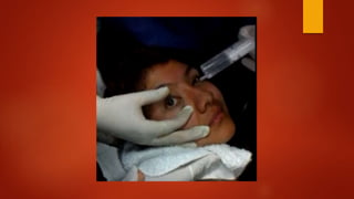 Lavado ocular y ótico | PDF