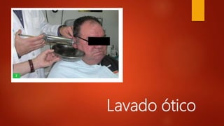 Lavado ocular y ótico | PDF