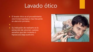 Lavado ocular y ótico | PDF