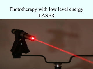 Low level energy Laser Therapy | PPS