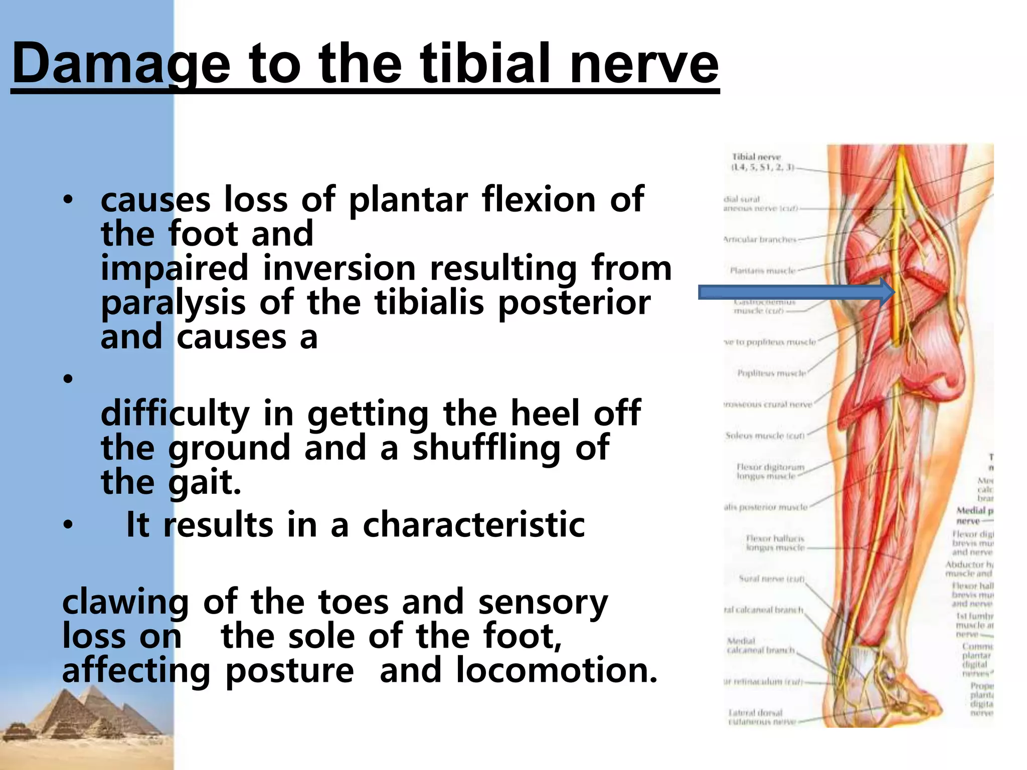 Lower limb nerve injuries | PPTX