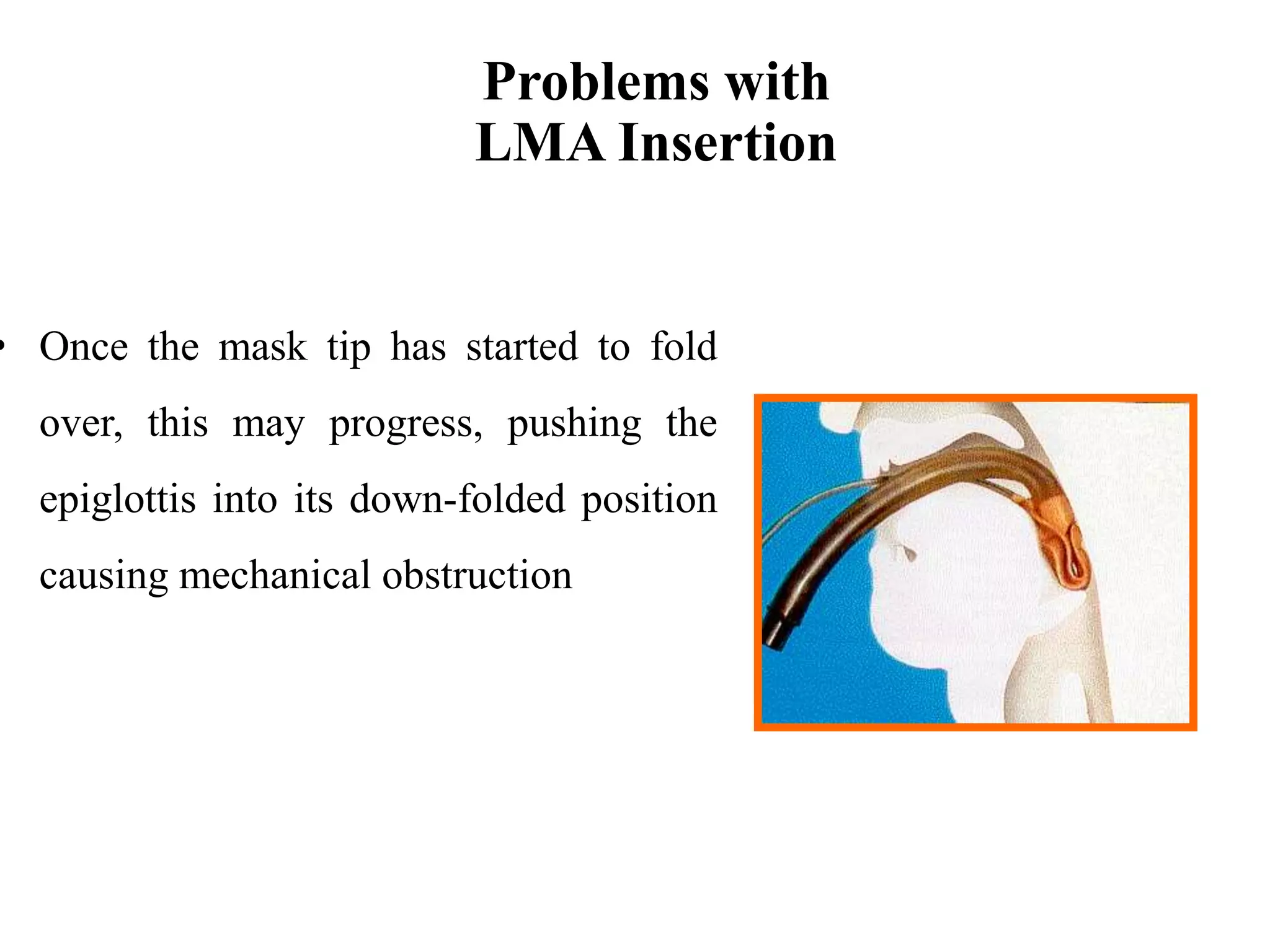 LMA (1).ppt