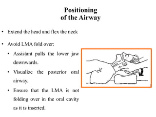 LMA (1).ppt