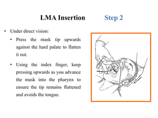 LMA (1).ppt