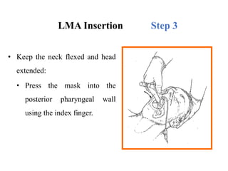 LMA (1).ppt