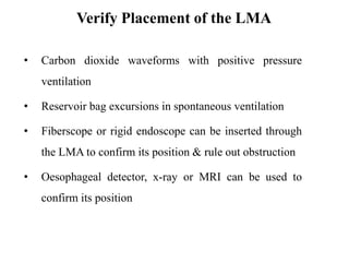 LMA (1).ppt