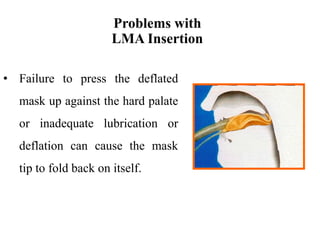 LMA (1).ppt