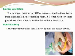 LMA (1).pptx about the tachycardia and the | PPT