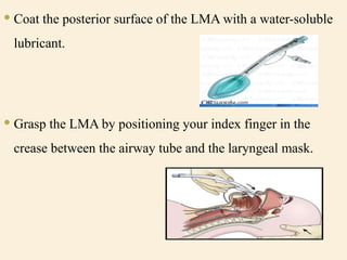 LMA (1).pptx about the tachycardia and the | PPTX