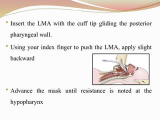 LMA (1).pptx about the tachycardia and the | PPT