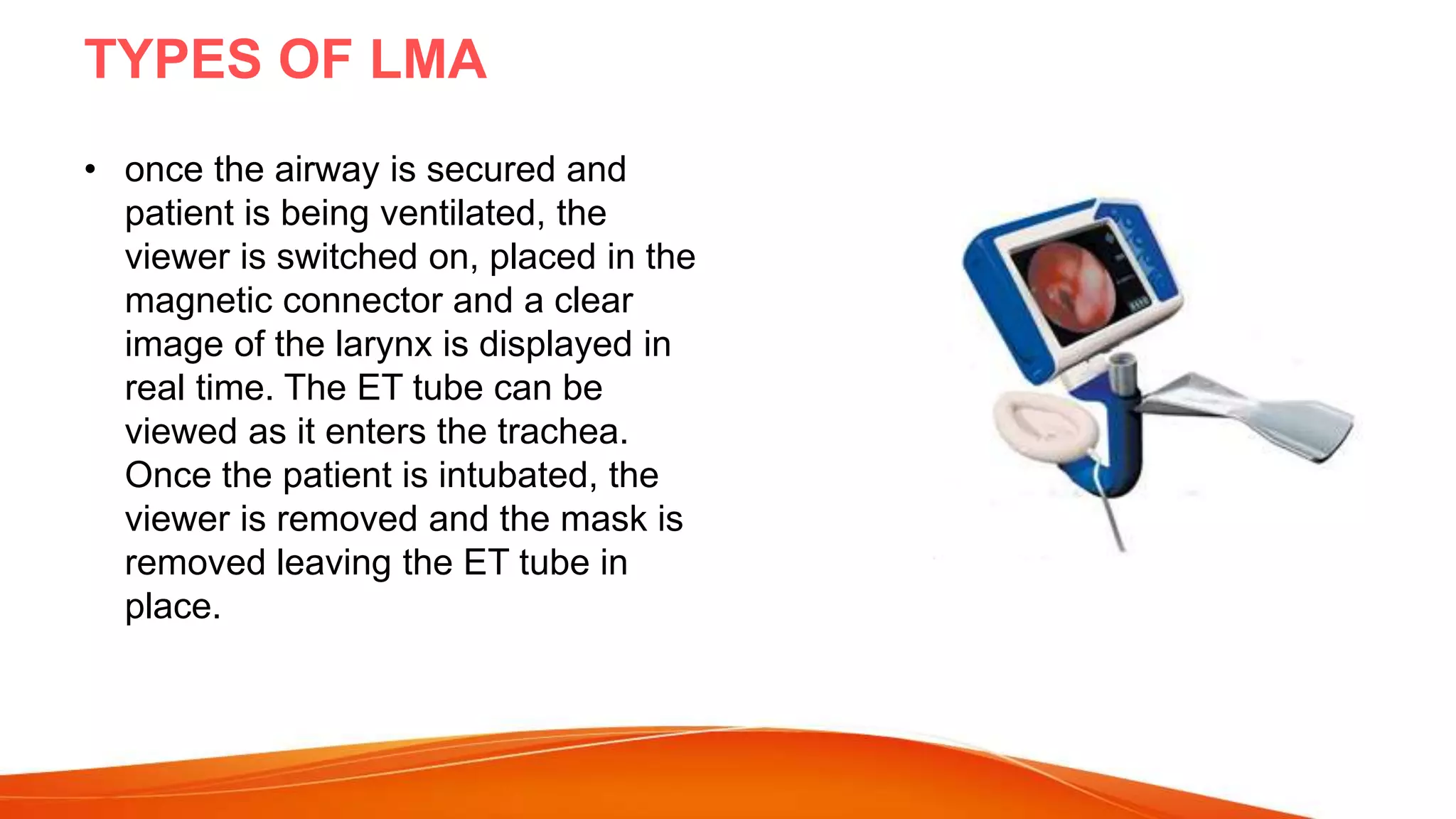 LAYNGEAL MASK AIRWAY | PPTX