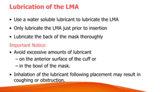 LAYNGEAL MASK AIRWAY | PPTX
