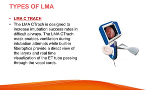 LAYNGEAL MASK AIRWAY | PPTX