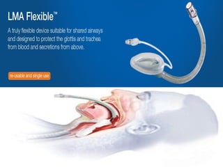 Lma in ent surgeries | PPT | Ear, Nose and Throat Conditions | Diseases ...