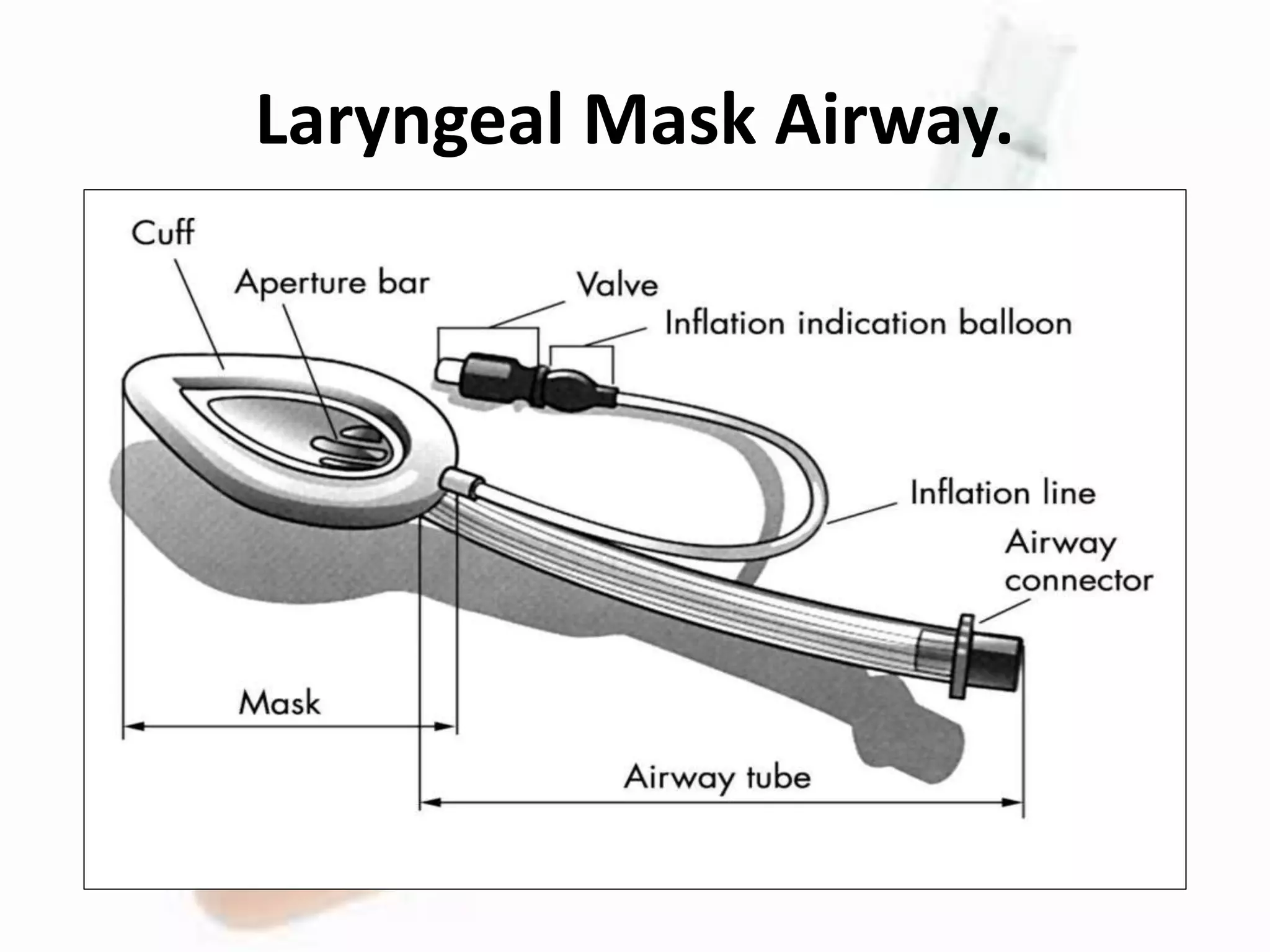 Lma, laryngospasm and pulmonary edema | PPTX | Ear, Nose and Throat ...