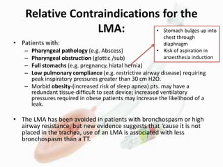 Lma, laryngospasm and pulmonary edema | PPTX