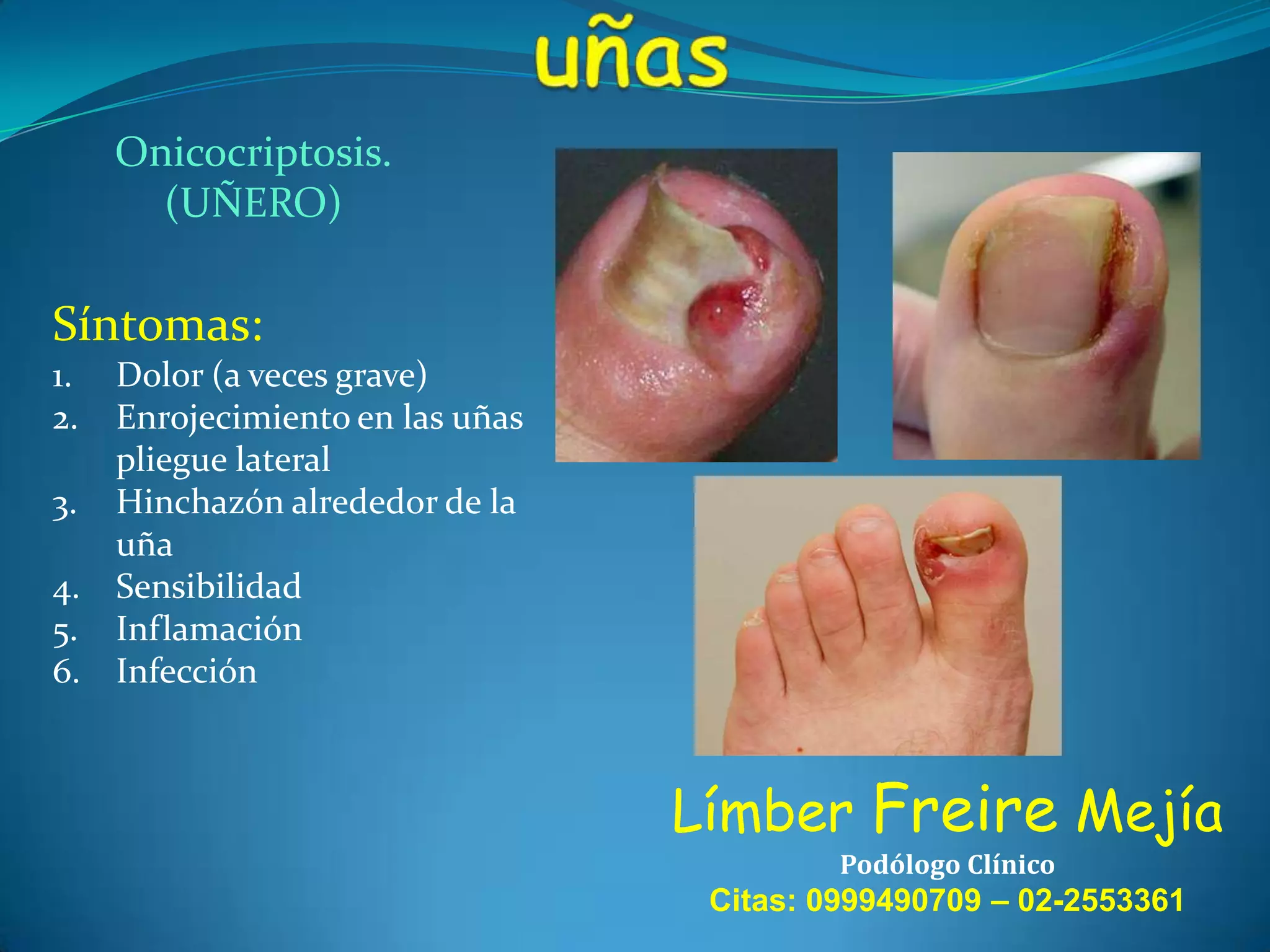 DR. LIMBER FREIRE CONFERENCIA "UÑAS" | PPTX