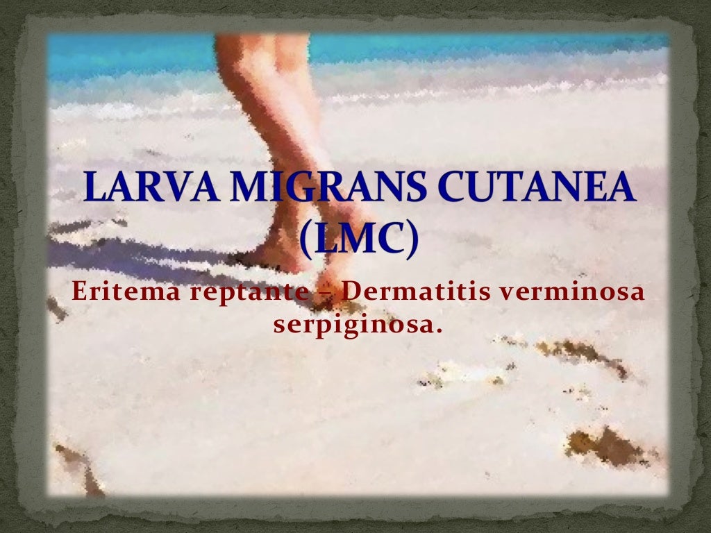 LARVA MIGRANS CUTANEA (LMC)