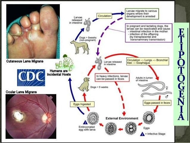 LARVA MIGRANS CUTANEA (LMC)