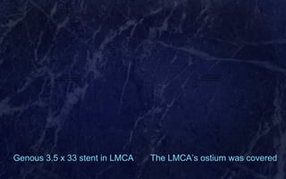 Lmca dissection | PPT