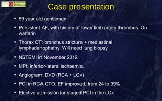 Lmca dissection | PPT