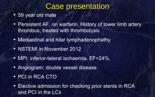 Lmca dissection | PPT
