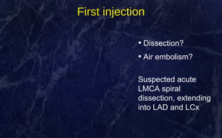 Lmca dissection | PPT