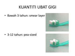 LATIHAN MEMBERUS GIGI (LMG) BERKESAN | PDF