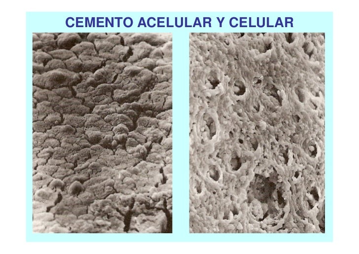 Lminashistologiadental