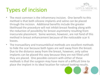 Everything you need to know about breast augmentation | PPT