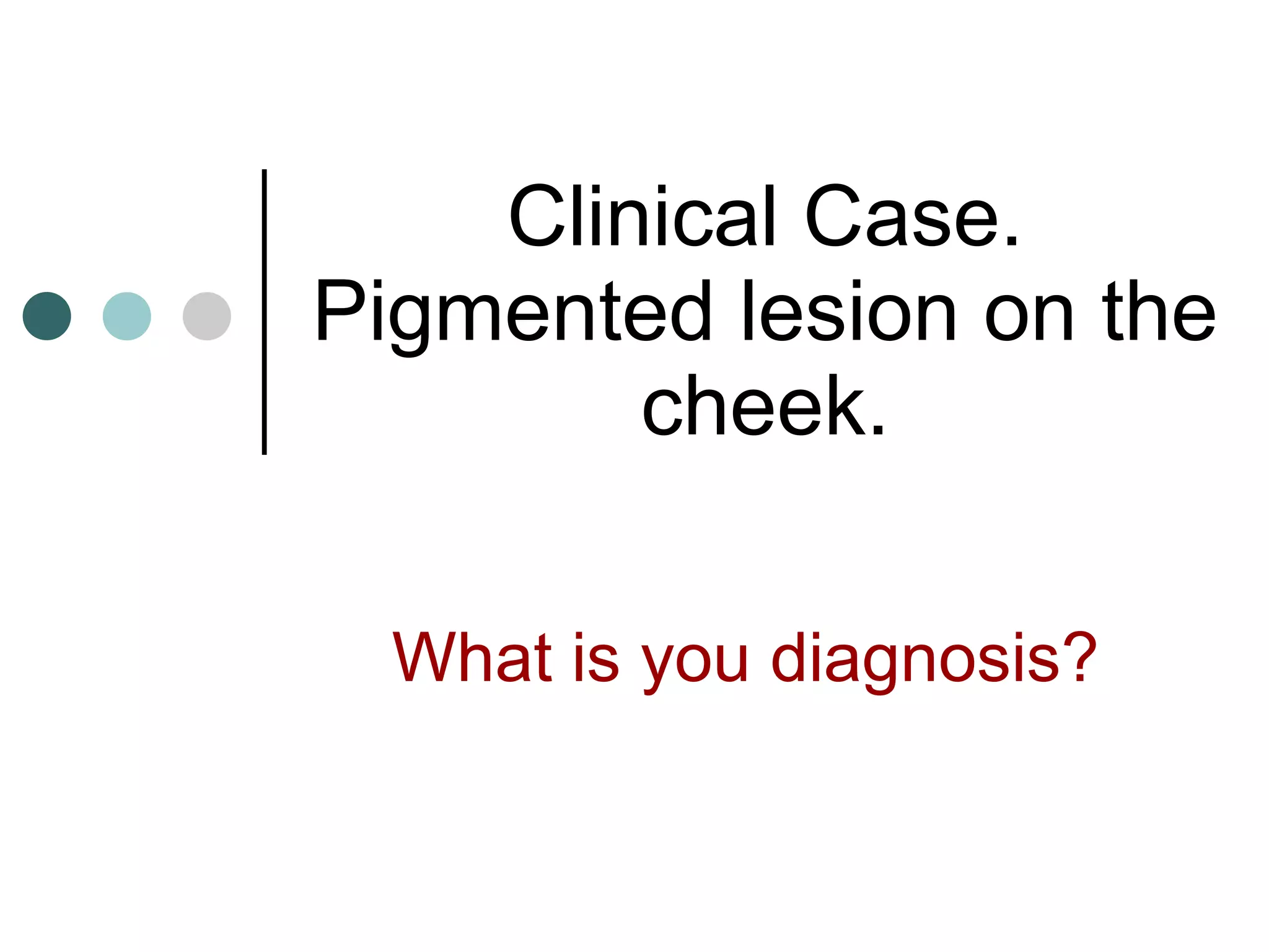 Clinical Case. Pigmented lesion on the cheek | PPT