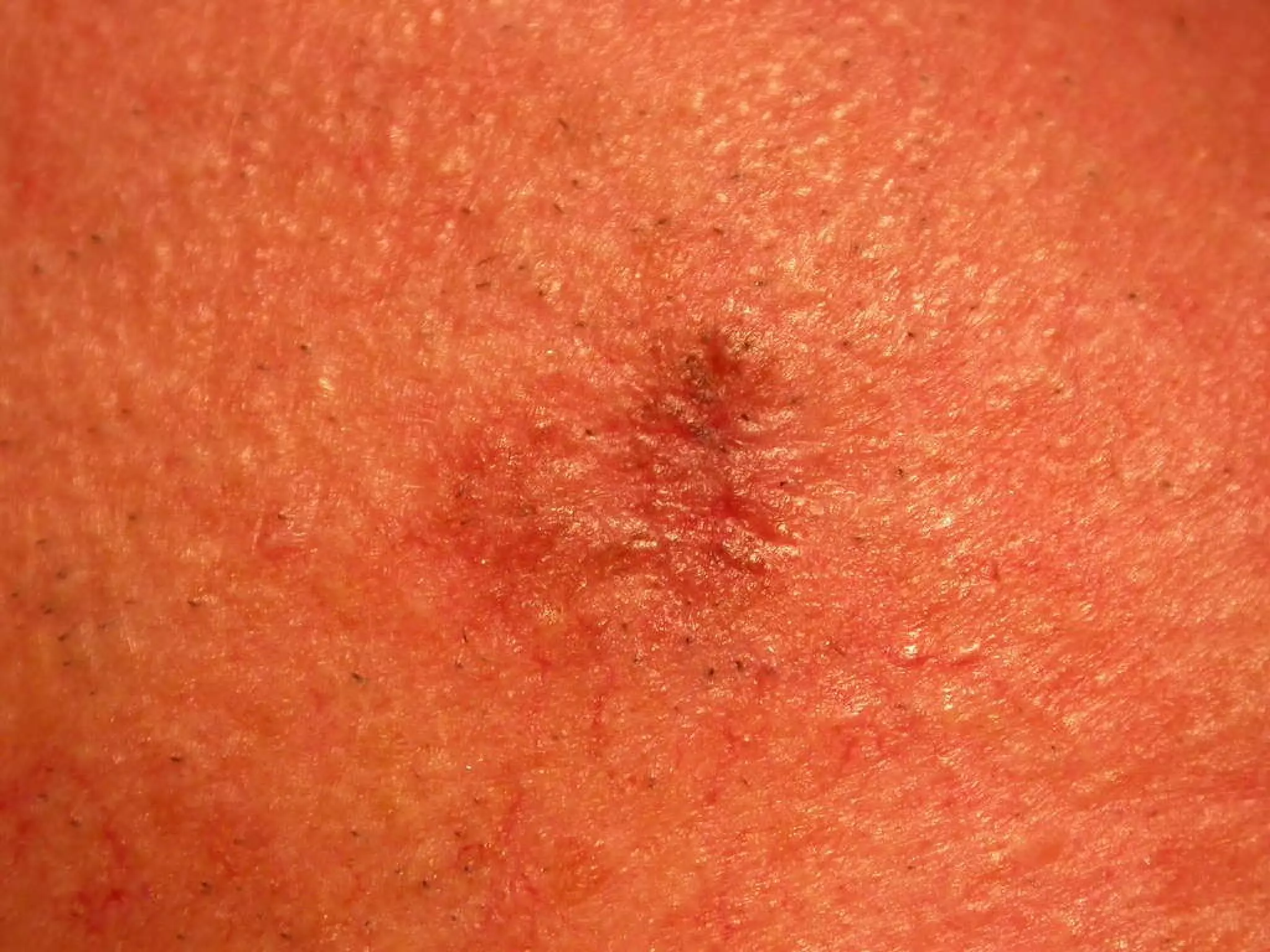 Clinical Case. Pigmented lesion on the cheek | PPT
