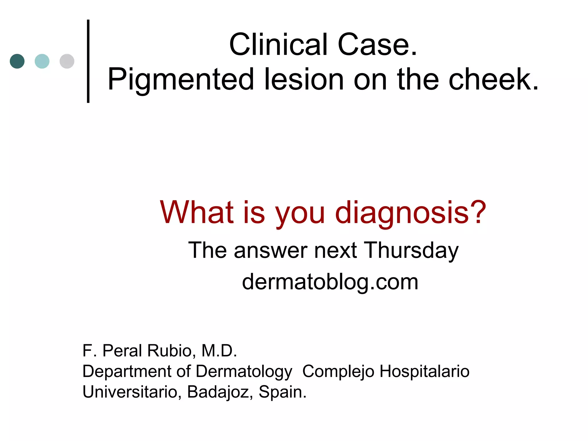 Clinical Case. Pigmented lesion on the cheek | PPT