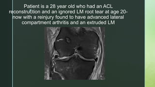 Lateral Meniscus Root Tears - Neglected Cases | PPTX