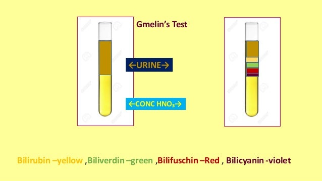 Haemoglobin metabolism and.its clinical applications pptx