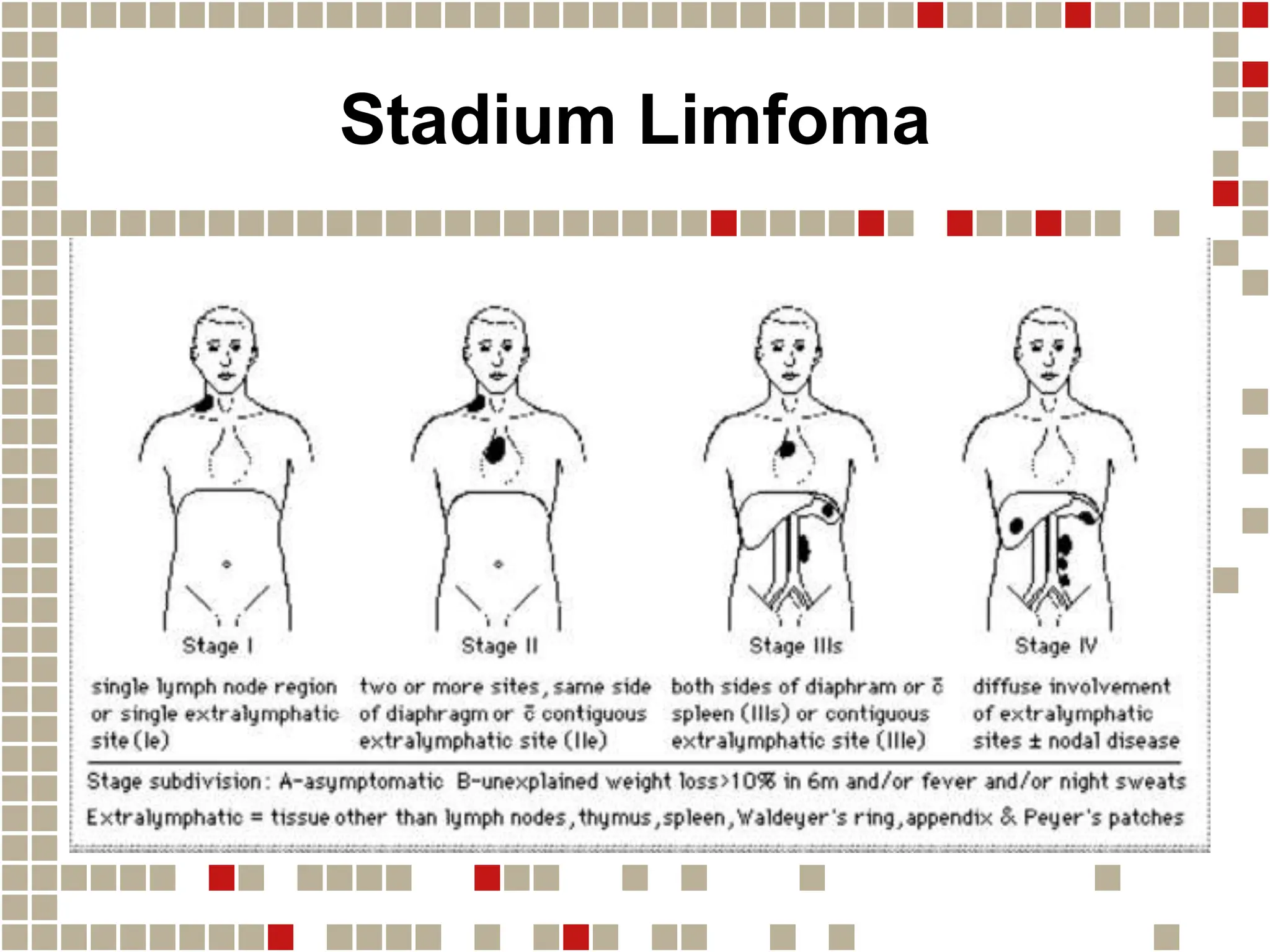 ASKEP Limfoma Non Hodgkin dlm keperawatan.ppt