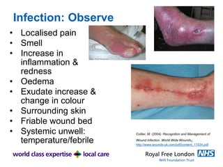 Wound Care | PDF