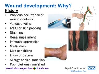 Wound Care | PDF