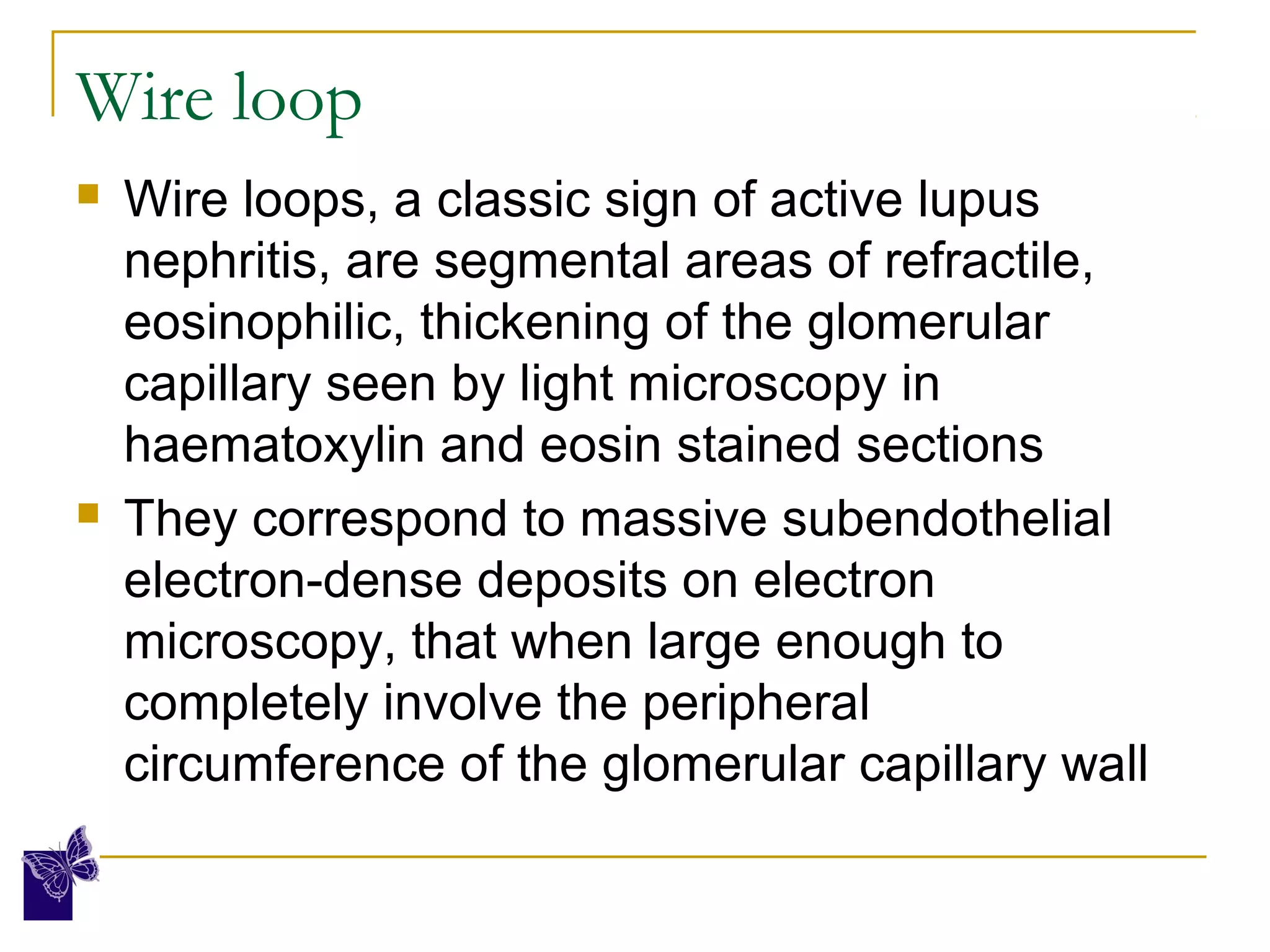 Pathophysiology of lupus nephritis | PPT