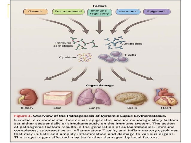 Pathophysiology of lupus nephritis