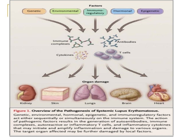 Pathophysiology of lupus nephritis