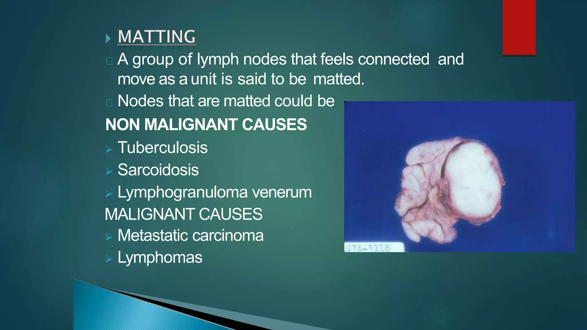 approach to lymph node cytology part 1 | PPTX