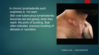 approach to lymph node cytology part 1 | PPTX