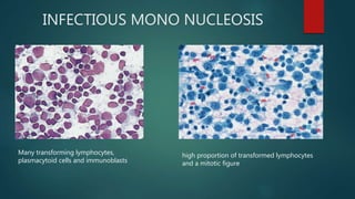 approach to lymph node cytology part 1 | PPTX