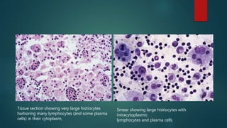 approach to lymph node cytology part 1 | PPTX