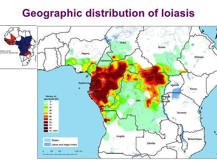Loa Loa cope by Dr. Nutman