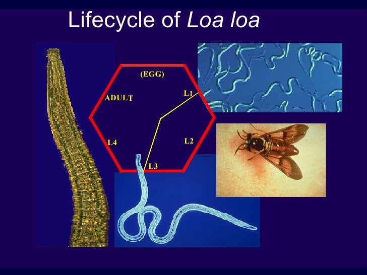 Loa Loa cope by Dr. Nutman