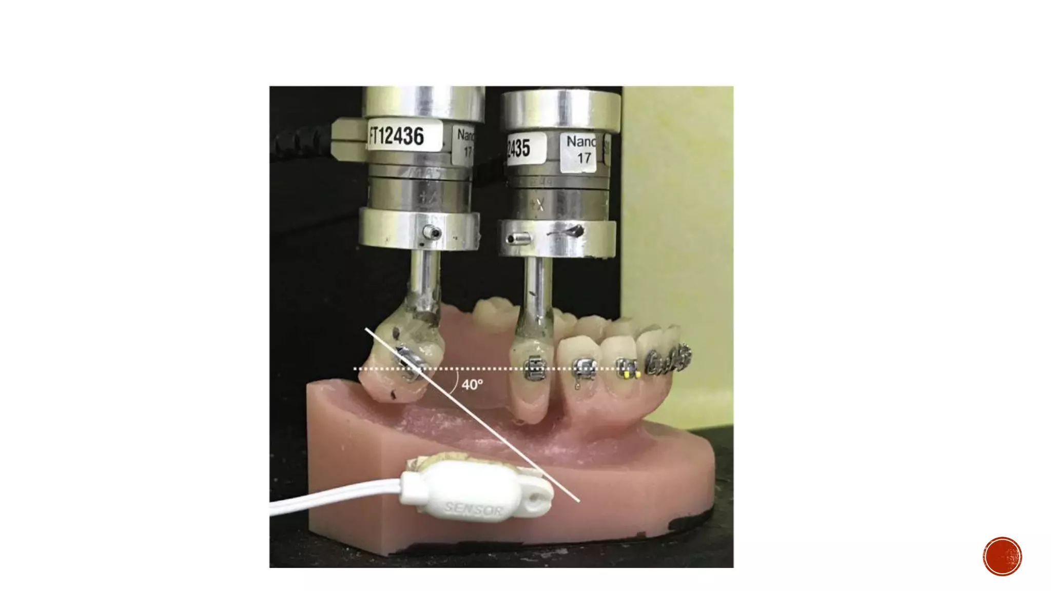 Loads of continuous mechanics for uprighting the second.pptx | Dental ...