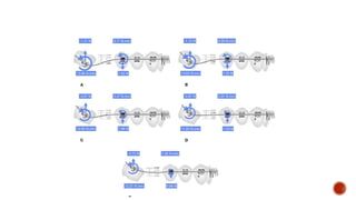 Loads of continuous mechanics for uprighting the second.pptx | Dental ...